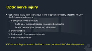 Physiology of the visual pathway & cerebral integration | PPTX