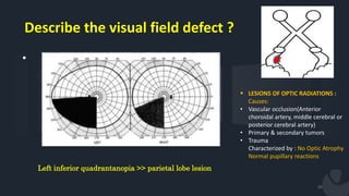 Physiology of the visual pathway & cerebral integration | PPTX