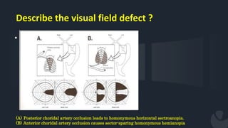Physiology of the visual pathway & cerebral integration | PPTX