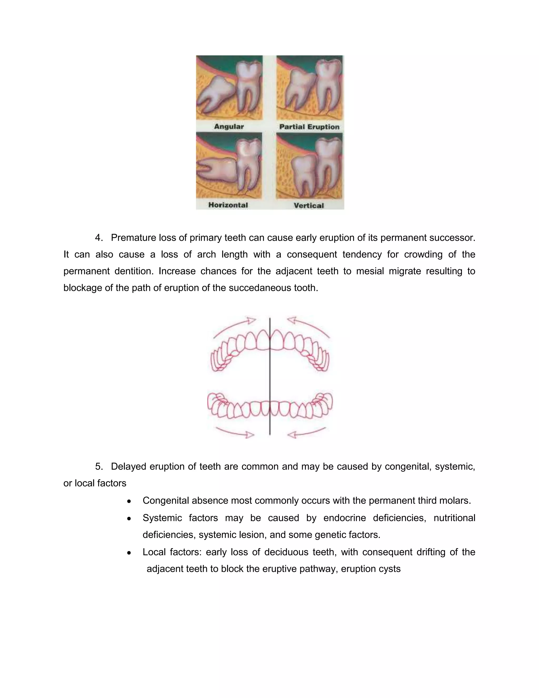 Physiology of tooth eruption | DOCX