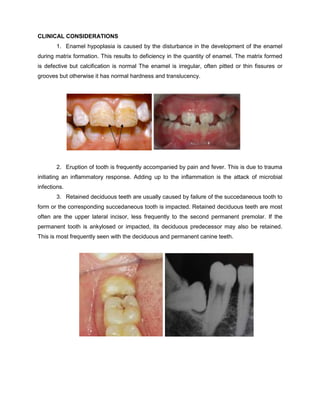 Physiology of tooth eruption | DOCX