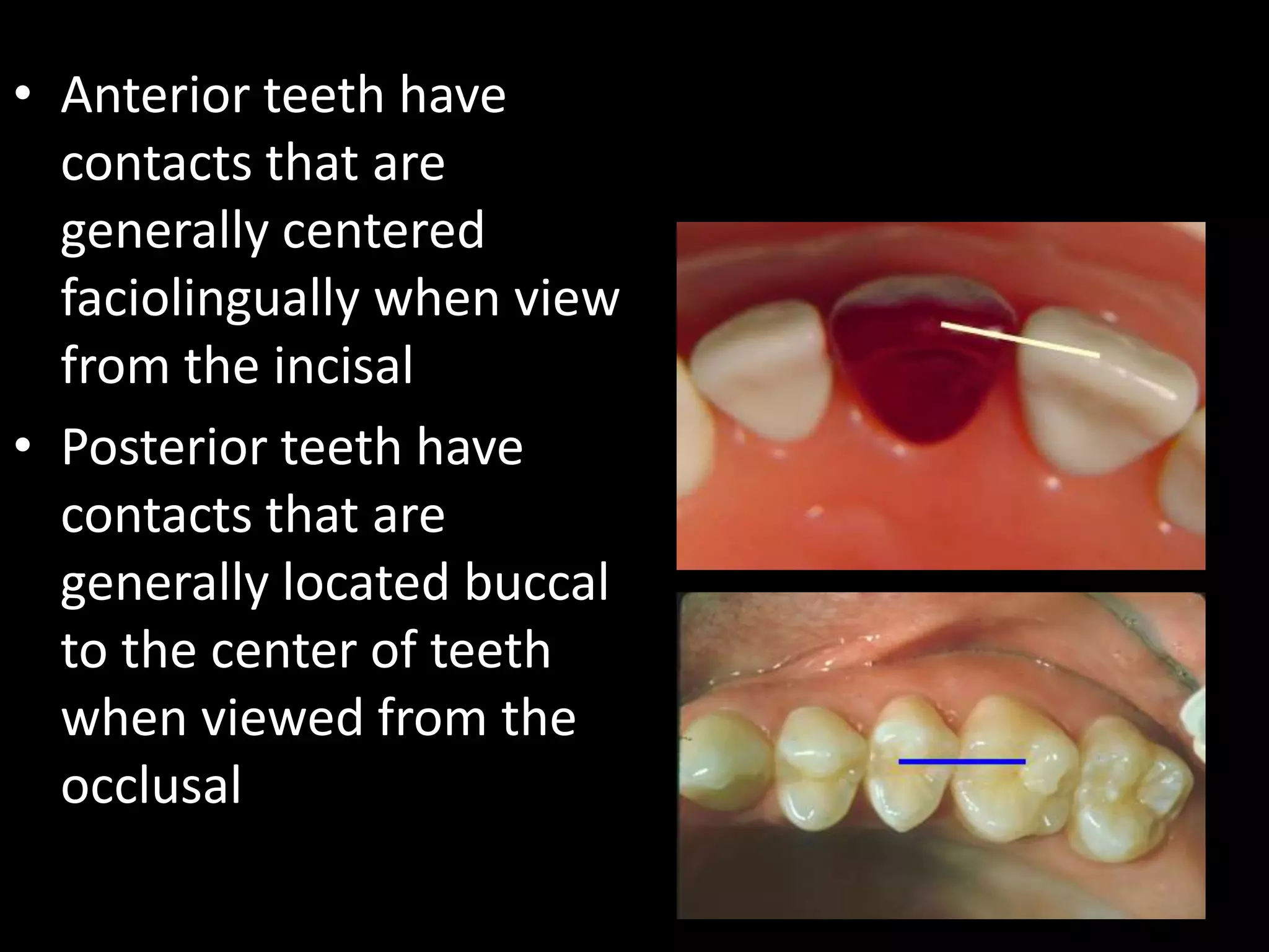 dental anatomy & physiology of permanent teeth | PPTX | Dental Health ...