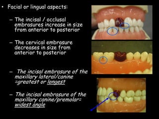 dental anatomy & physiology of permanent teeth | PPT