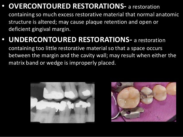 dental anatomy & physiology of permanent teeth