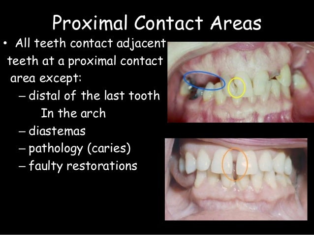 dental anatomy & physiology of permanent teeth