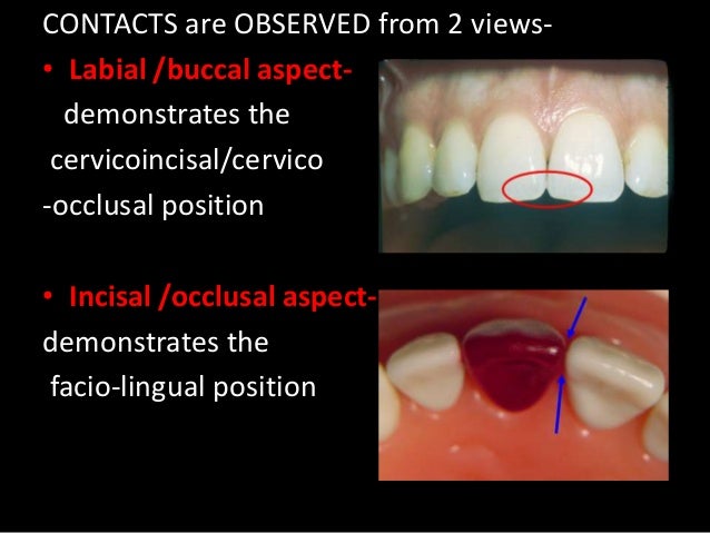 dental anatomy & physiology of permanent teeth