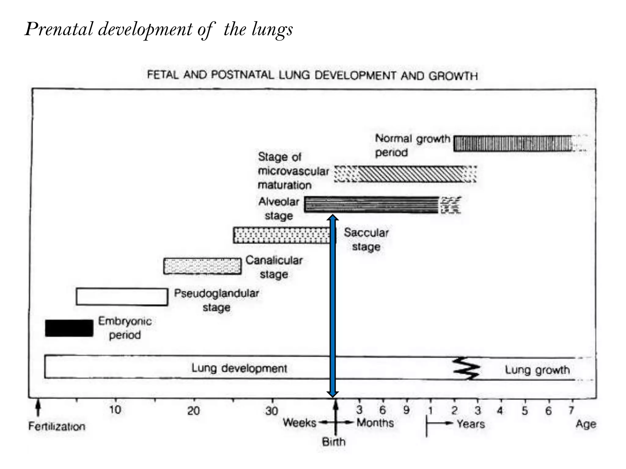 Physiology of transition period in a neonate (Respiratory System) | PPTX
