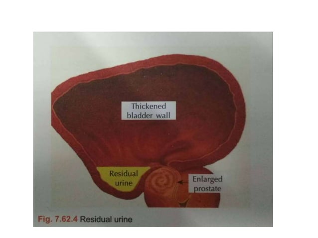 Physiology of urinary bladder.pptx