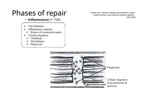 Physiology of wound and tendon healing.pptx