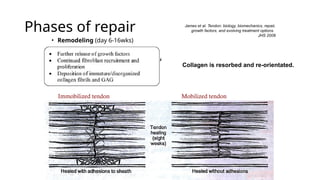 Physiology of wound and tendon healing.pptx