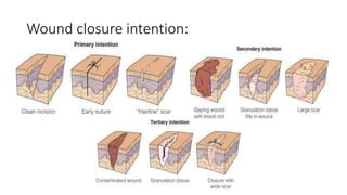 Physiology of wound healing | PPTX
