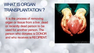 Organ Transplantation | PPT