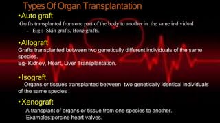 Organ Transplantation | PPT