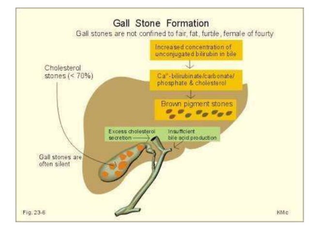 Physiology properties of bile, composition of bile, functions of bile ...