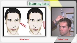 Physiology (sensory examination tests) | PDF