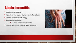 physiology skin diorder.pptx