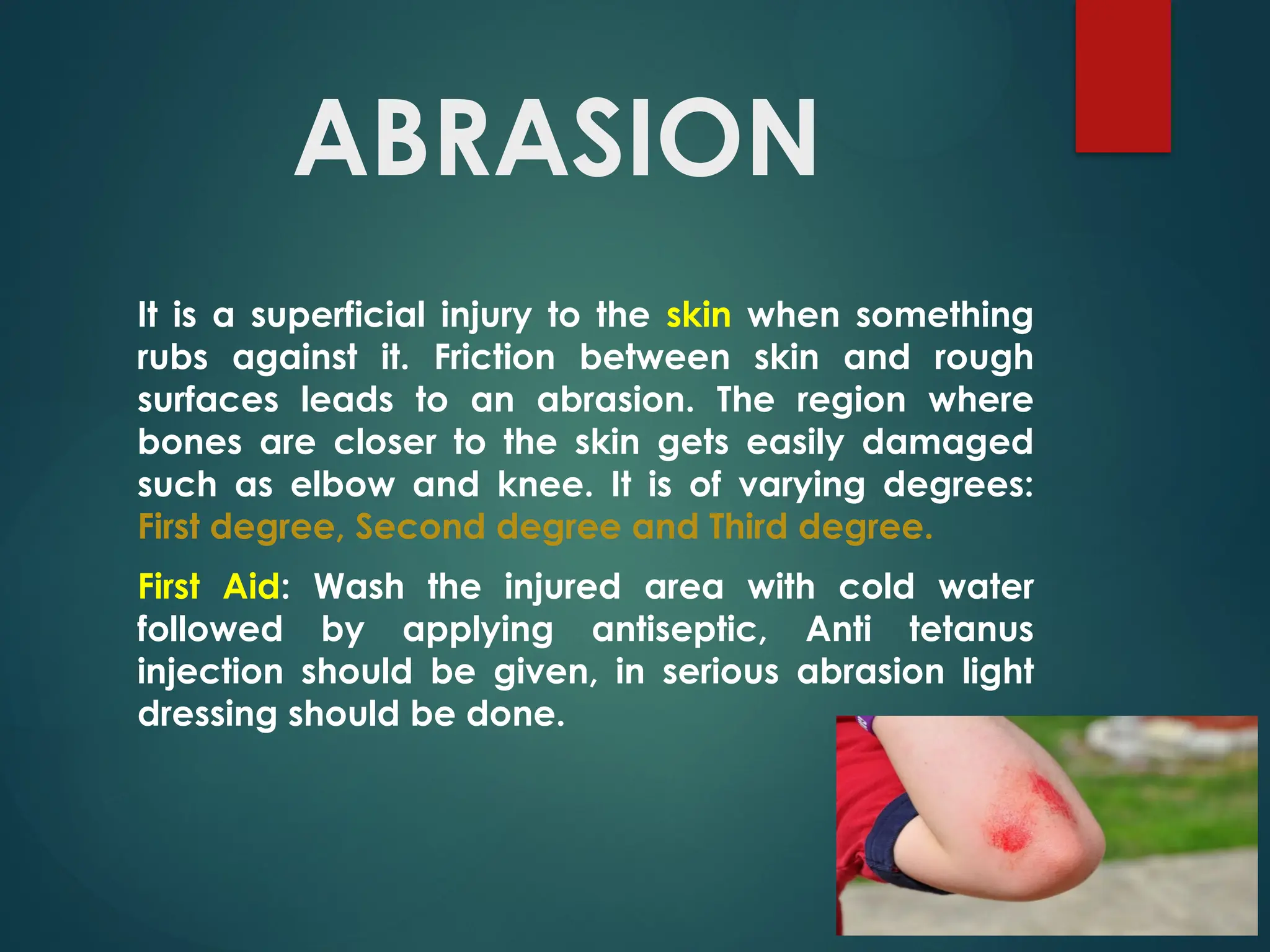 PHYSIOLOGY & SPORTS INJURY by Diwakar Sir | PPTX