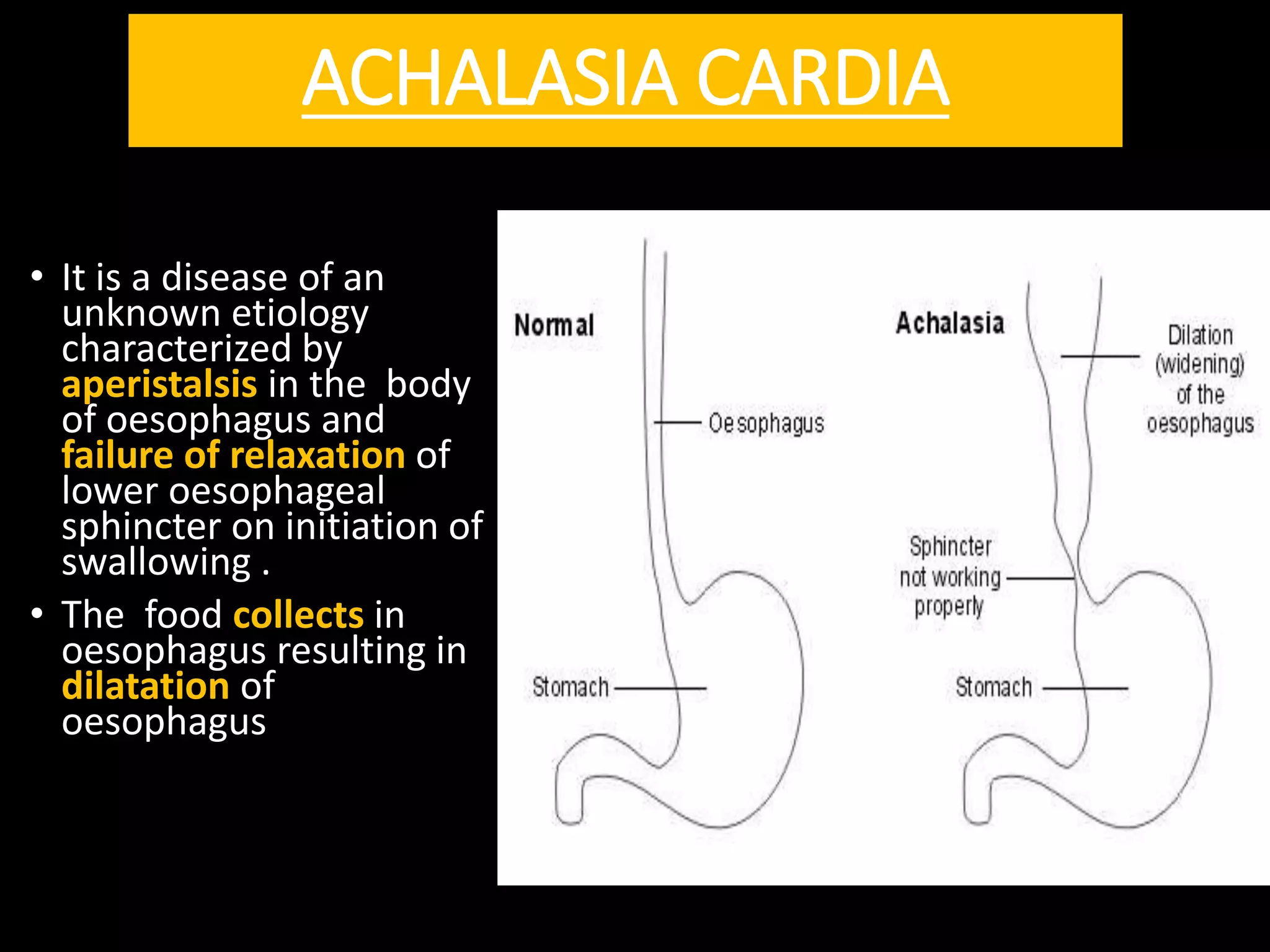 Mastication And Deglutition | PPTX
