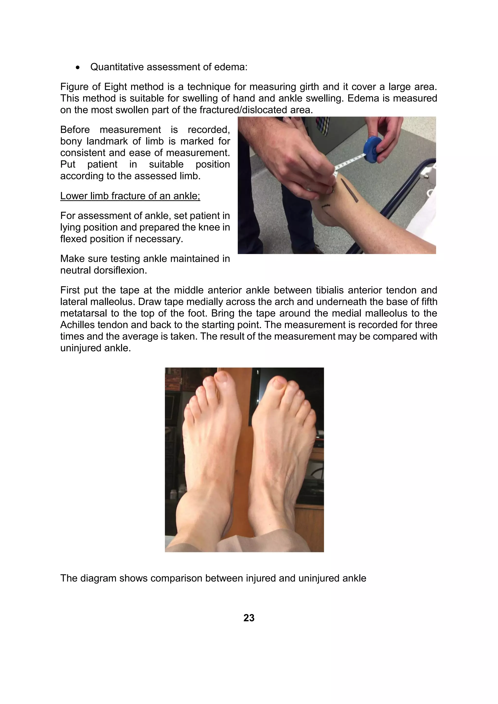 Physiotherapy assessment in fracture and dislocation edited | PDF