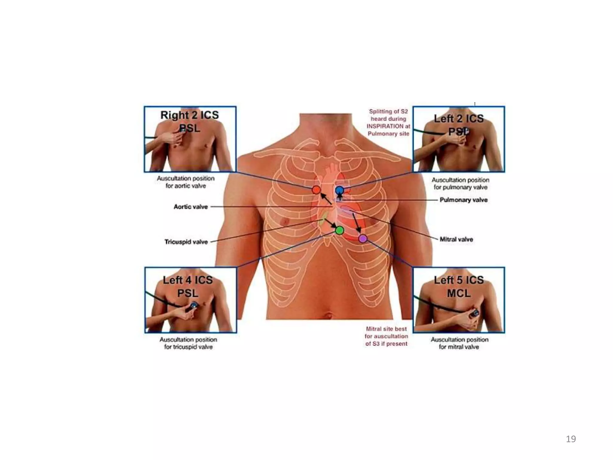 Physiotherapy assessment of cardiac conditions | PPTX
