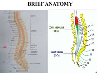 PHYSIOTHERAPY ASSESSMENT IN PATIENT WITH CAUDAL EQUINAL SYNDROME | PPTX