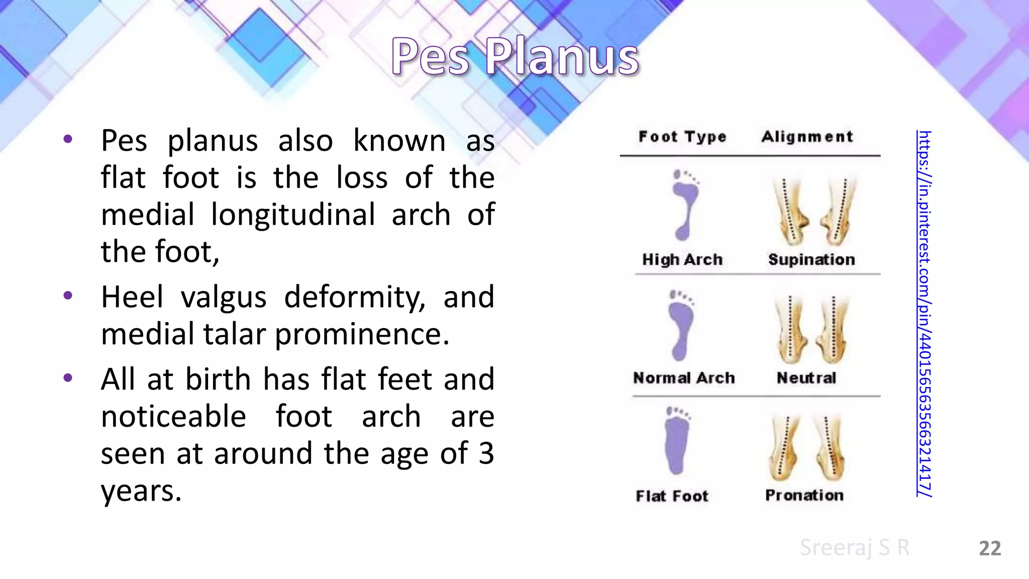 Physiotherapy for ankle & foot deformities | PPTX