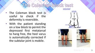 Physiotherapy for ankle & foot deformities | PPTX