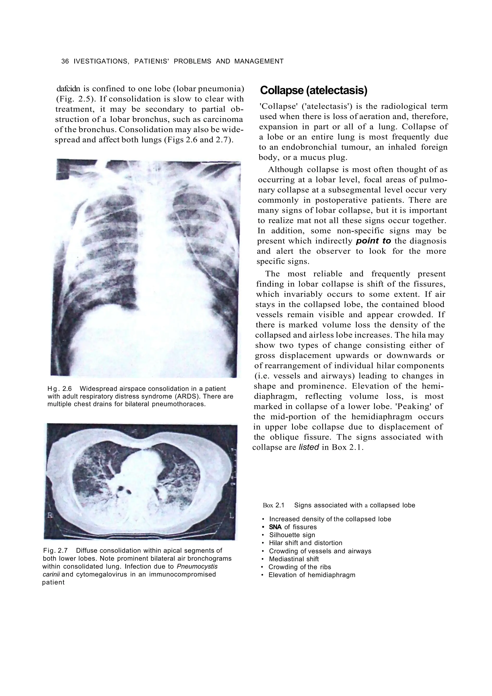 Physiotherapy_for_Respiratory_and_Cardiac_Problems WEBBER.pdf