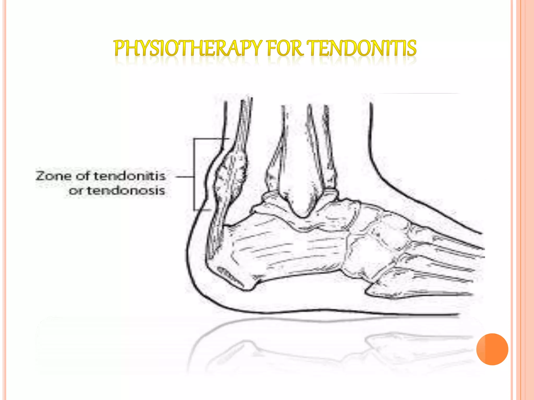 Physiotherapy for Tendonitis Symptoms and Problems | PPT