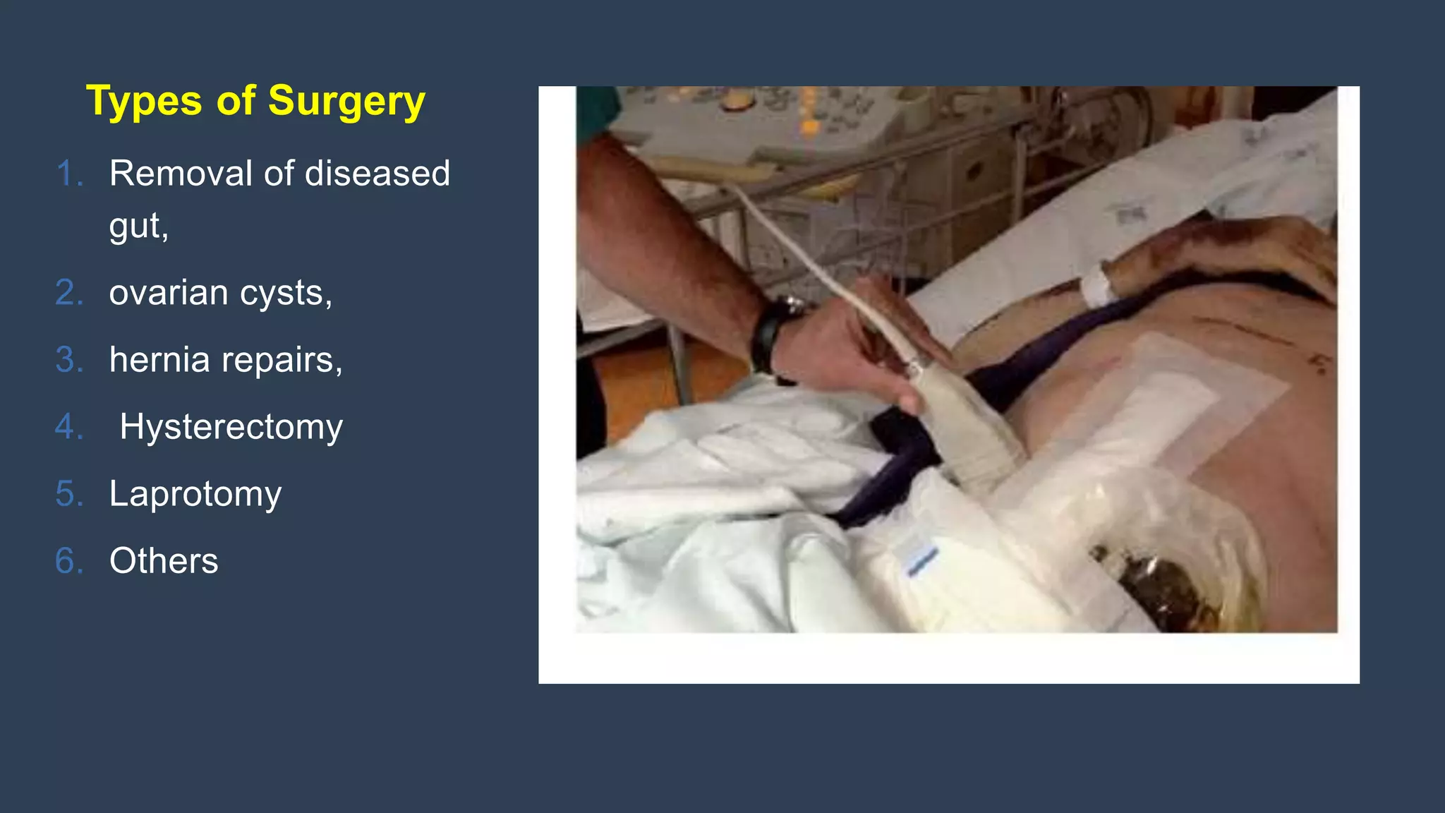 Physiotherapy in abdominal surgery | PPTX