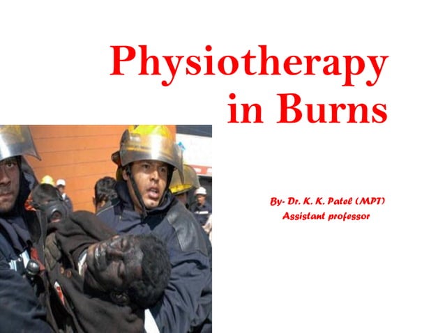 Physiotherapy in burns | PPT | Physical Therapy | Wellness