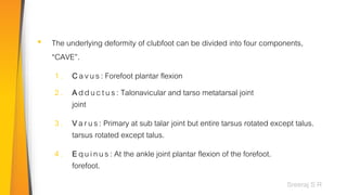 Physiotherapy for CONGENITAL TALIPES EQUINOVARUS | PPTX