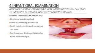 PHYSIOTHERAPY IN LACTATION & BREASTFEEDING.pptx