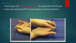 Physiotherapy in Reconstructive Surgery .pptx