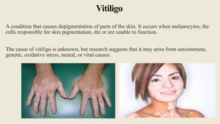 Physiotherapy Management in all type of Skin ConditionsPPT | PPTX
