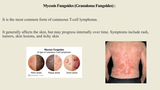 Physiotherapy Management in all type of Skin ConditionsPPT | PPTX