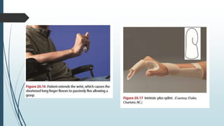 Physiotherapy in spinal cord injury | PPTX