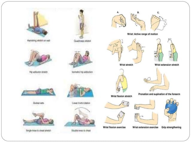 Physiotherapy management for rheumatoid arthritis | PPTX | Physical ...