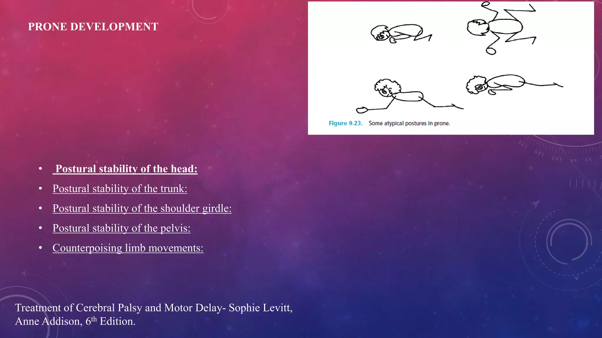 PHYSIOTHERAPY MANAGEMENT IN CEREBRAL PALSY.pptx