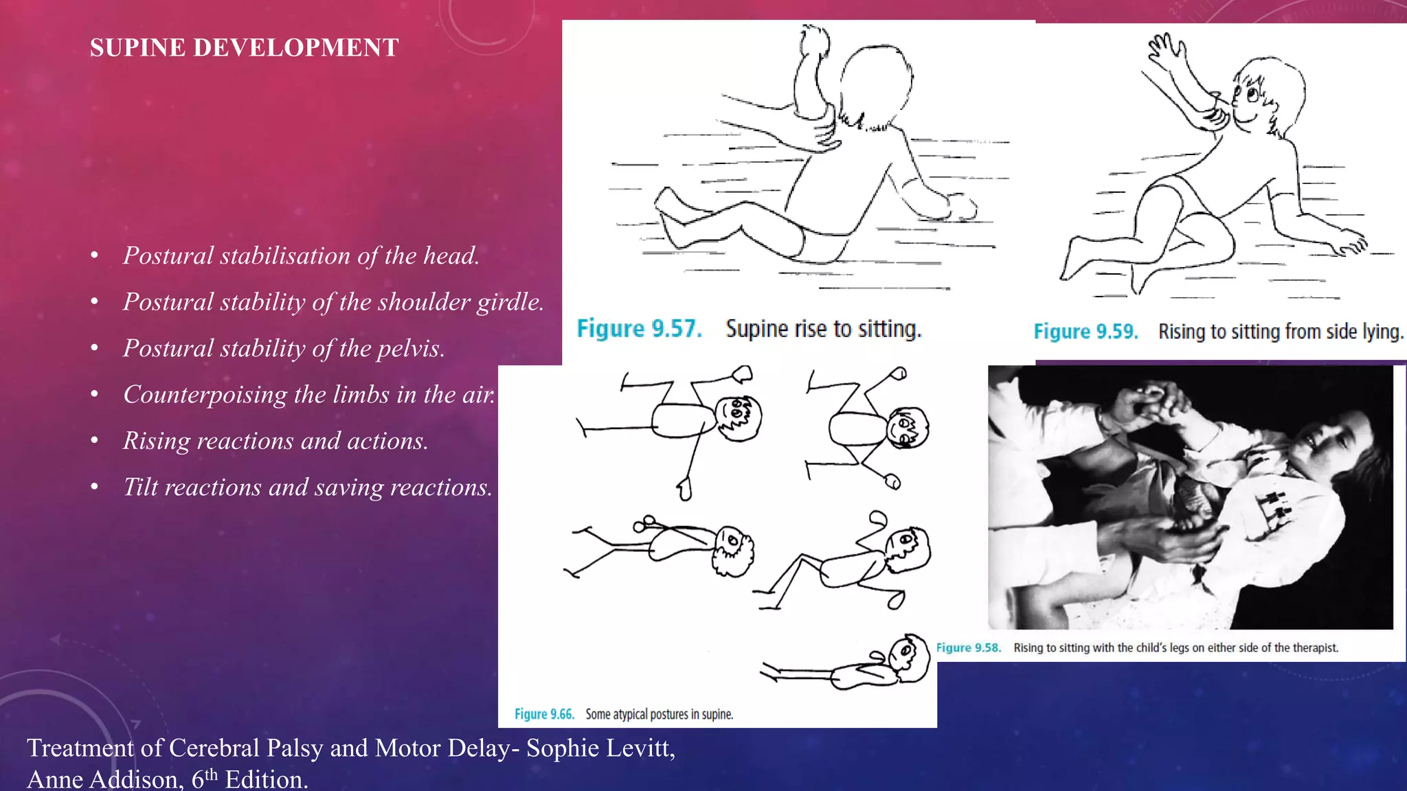 PHYSIOTHERAPY MANAGEMENT IN CEREBRAL PALSY.pptx