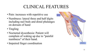 PHYSIOTHERAPY MANAGEMENT OF Carpal Tunnel Syndrome .pdf