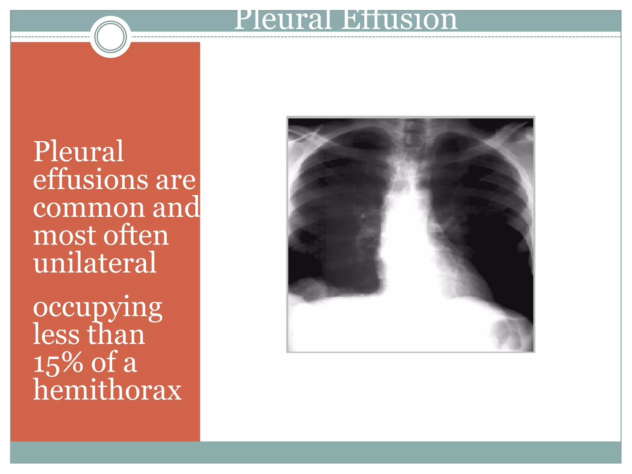 Rehabilitation of patient with pleural effusion | PDF