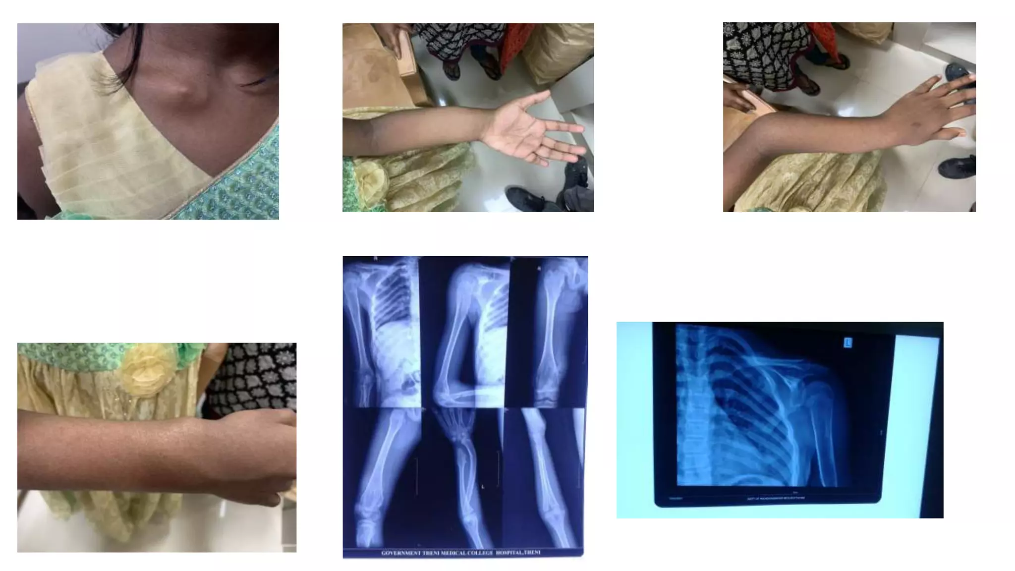 Physis-Development,Anatomy,Physiology,Pathology,Diseases | PPT