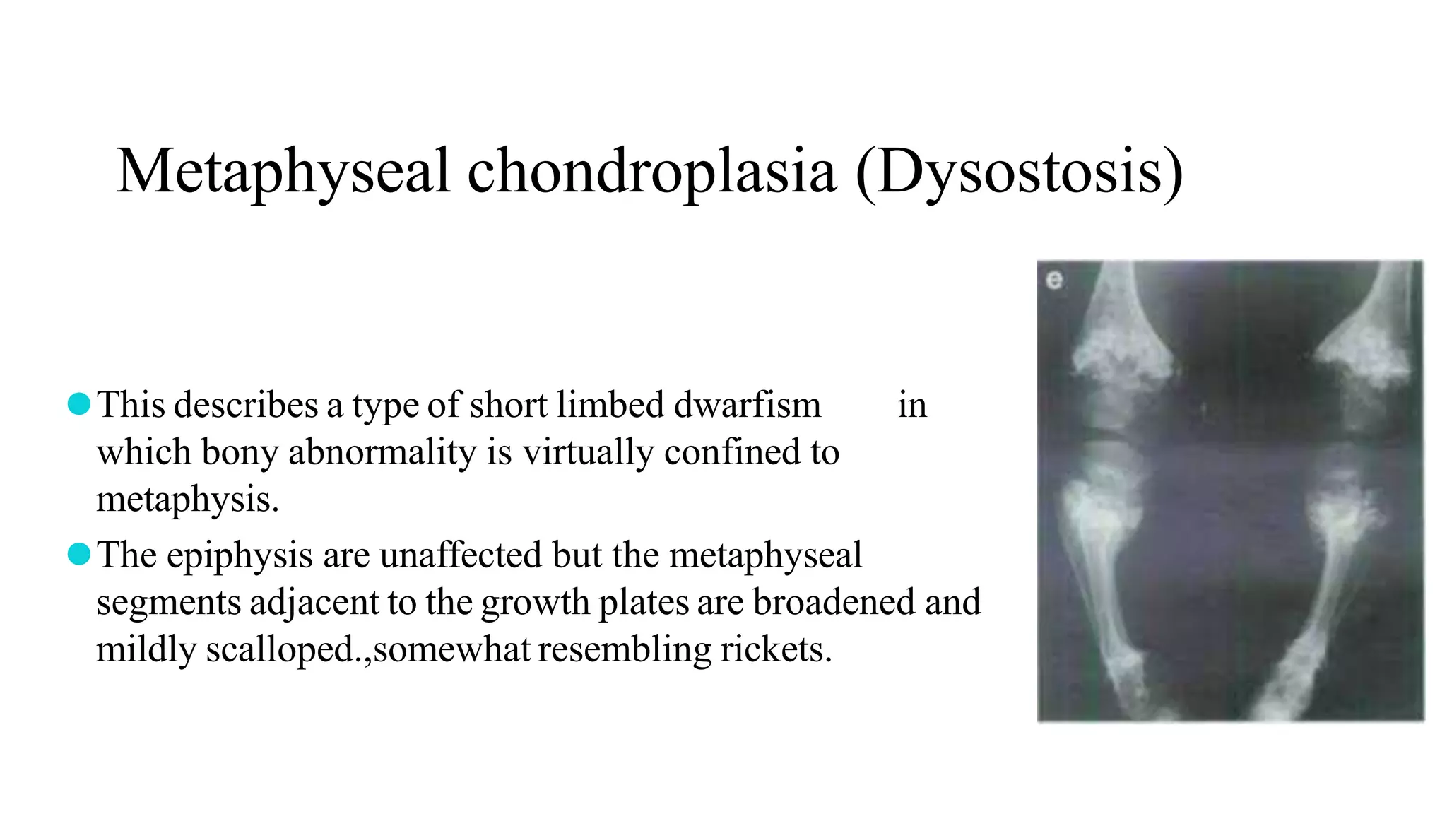 Physis-Development,Anatomy,Physiology,Pathology,Diseases | PPT