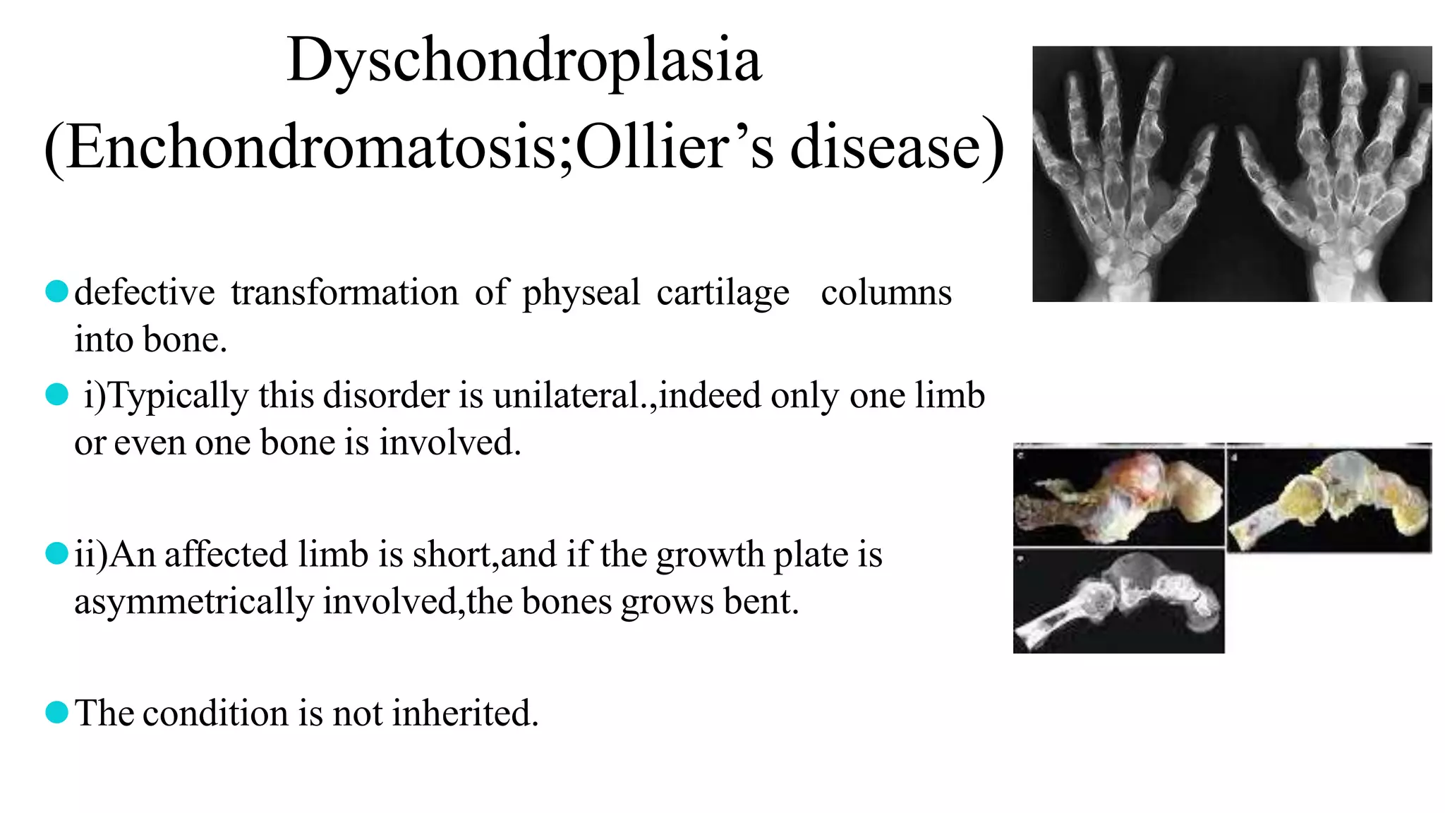 Physis-Development,Anatomy,Physiology,Pathology,Diseases | PPT