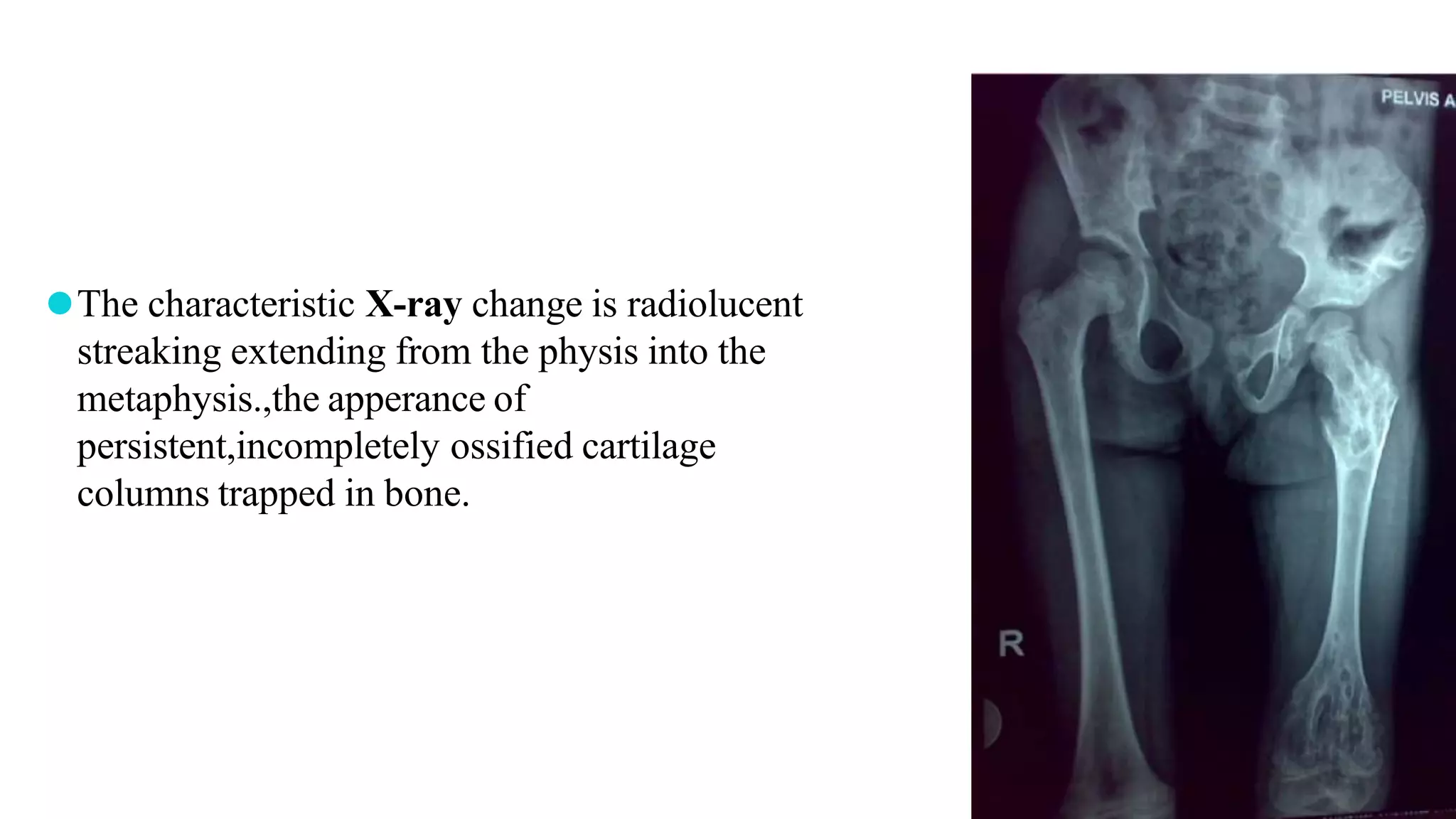 Physis-Development,Anatomy,Physiology,Pathology,Diseases | PPT