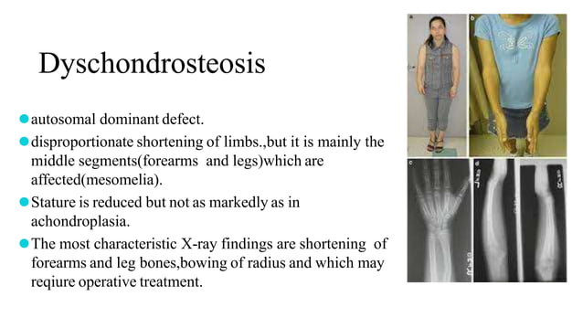 Physis-Development,Anatomy,Physiology,Pathology,Diseases | PPT