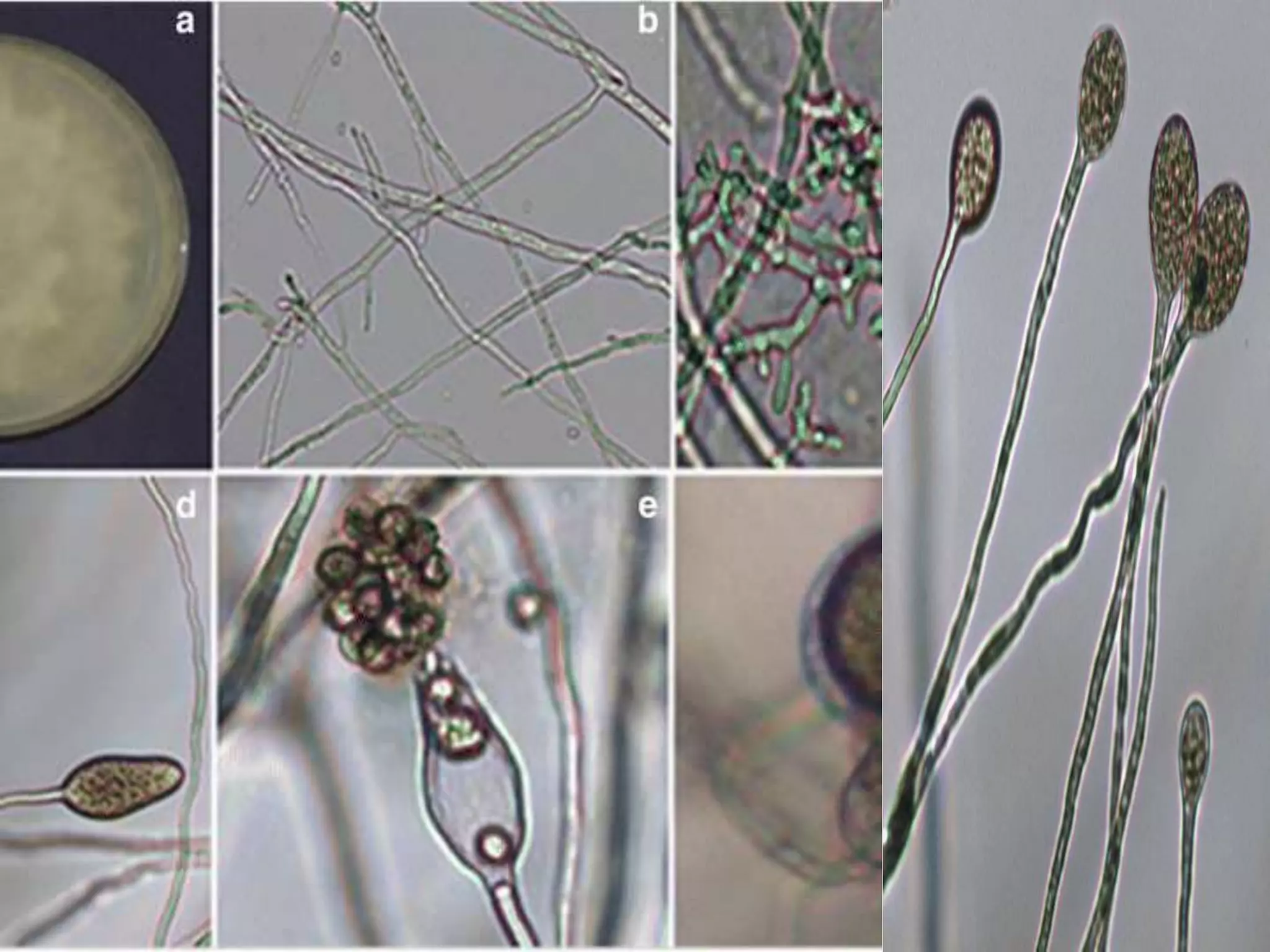 Phytopthora blight of pigeon pea | PPTX