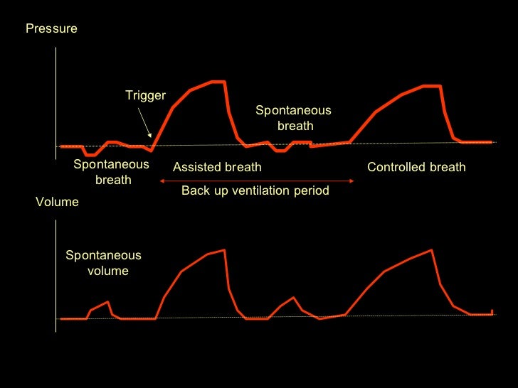 Physics of mechanical ventilation