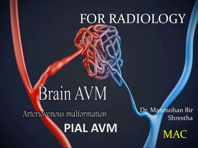 Cerebral/Pial Arteriovenous Malformation (AVM) | PPTX | Brain and ...